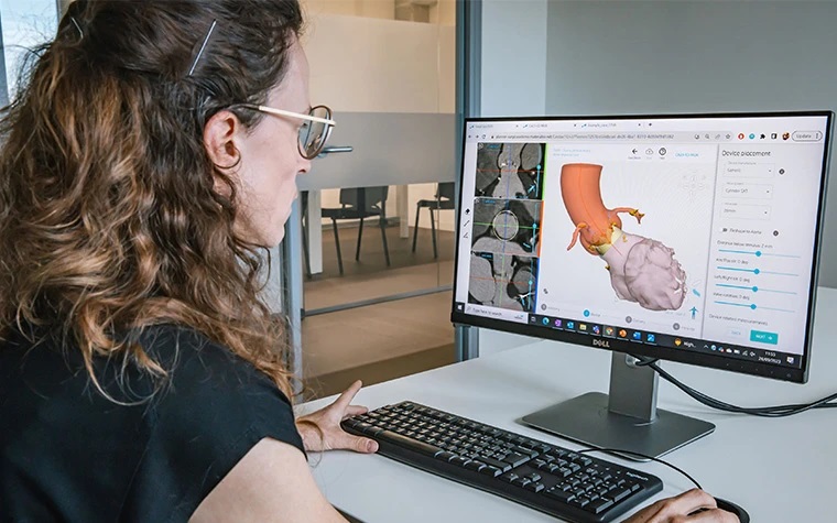 Materialise amplía las soluciones cardiovasculares con la compra de FEops